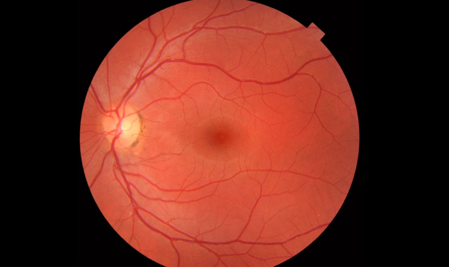 Home - Retina Institute of Arizona